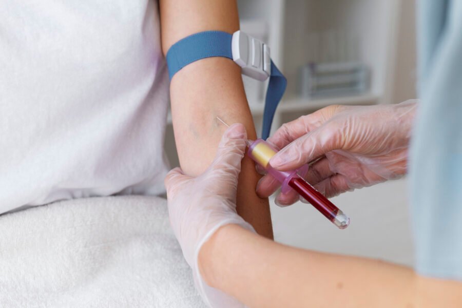 Menyelami Dunia Pemeriksaan SGOT: Memahami Kesehatan Hati Anda ... Menyelami Dunia Pemeriksaan SGOT: Memahami Kesehatan Hati Anda ...